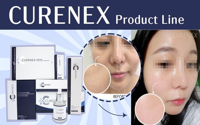 What is Curenex? Understanding Its Uses and Benefits