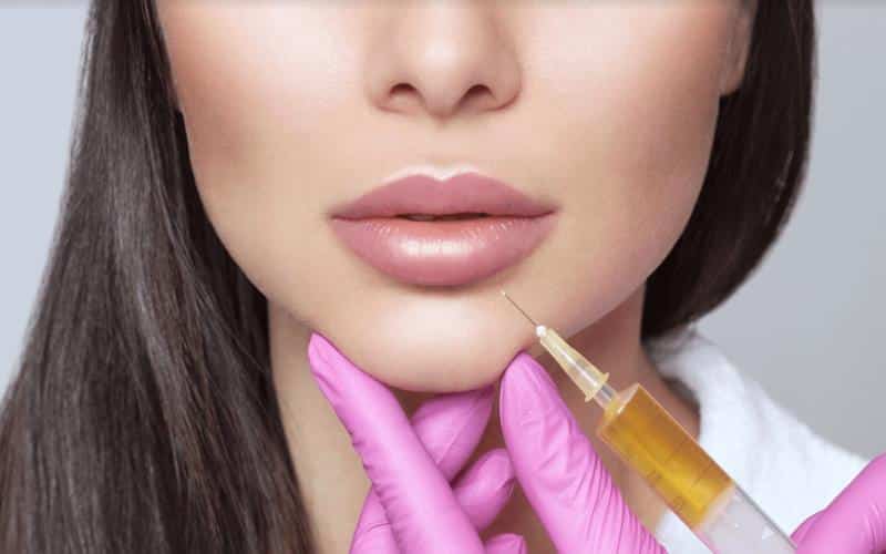 12 Common Questions About Lip Fillers Answered